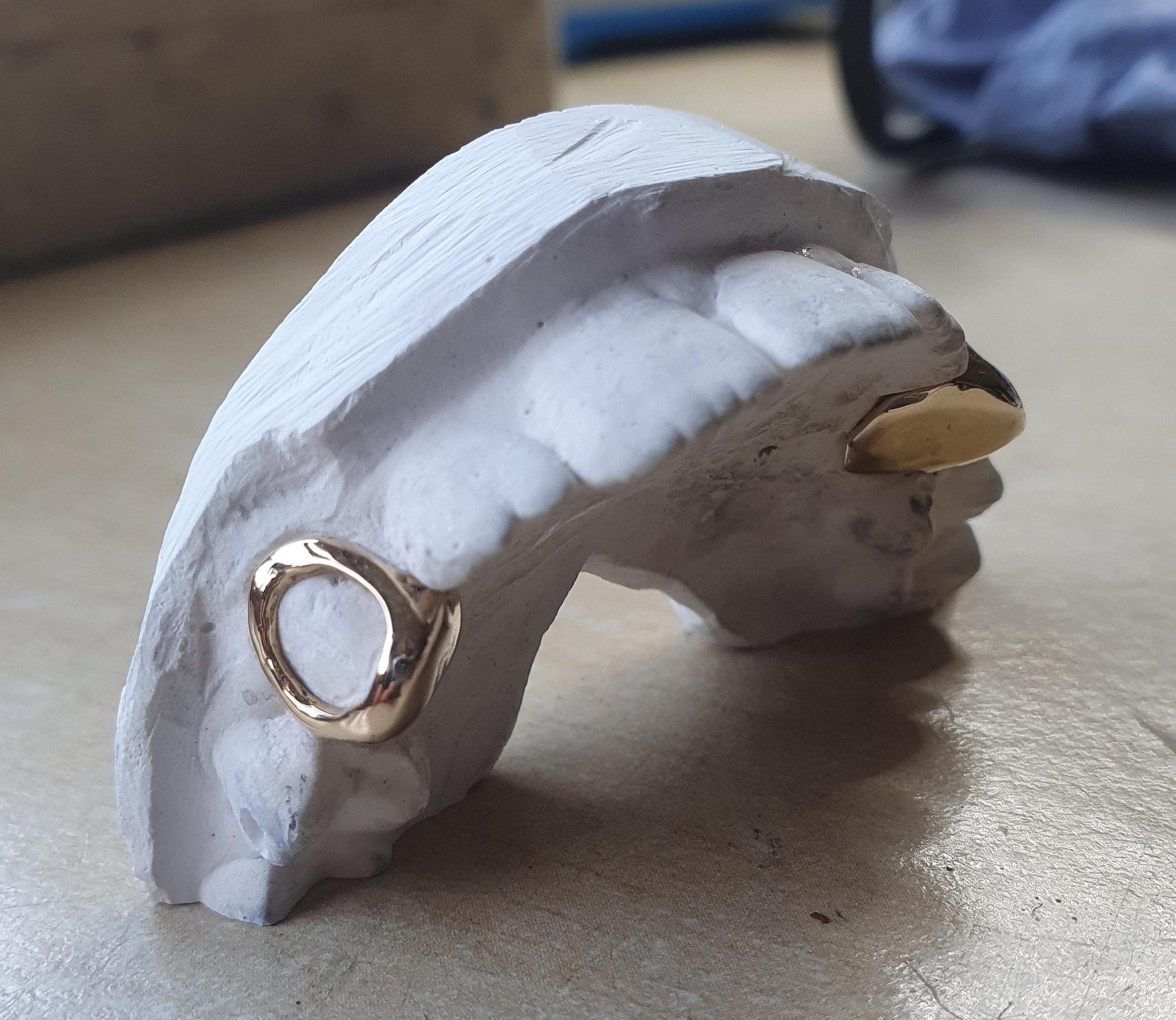 WINDOW Custom Grillz Dental Caps Worldwide Delivery - Etsy