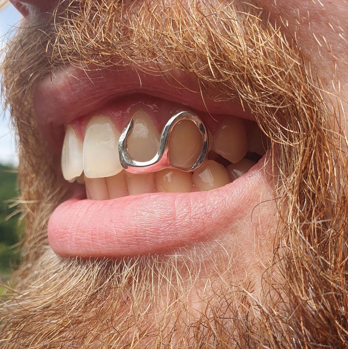 WAVE Custom Grillz Dental Caps Worldwide Delivery - Etsy