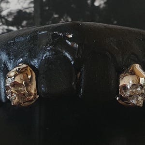 SKULL Custom Grillz Dental Caps Worldwide Delivery - Etsy
