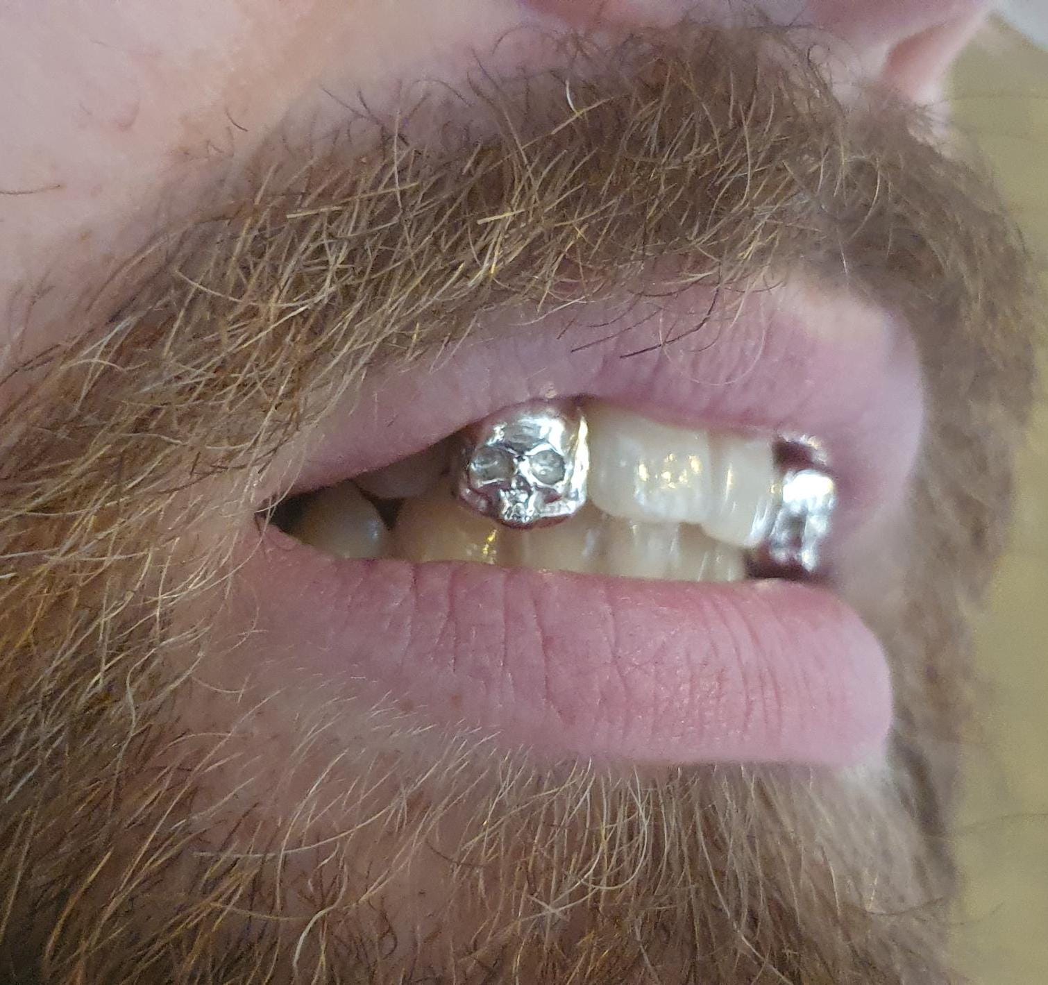 SKULL Custom Grillz Dental Caps Worldwide Delivery - Etsy