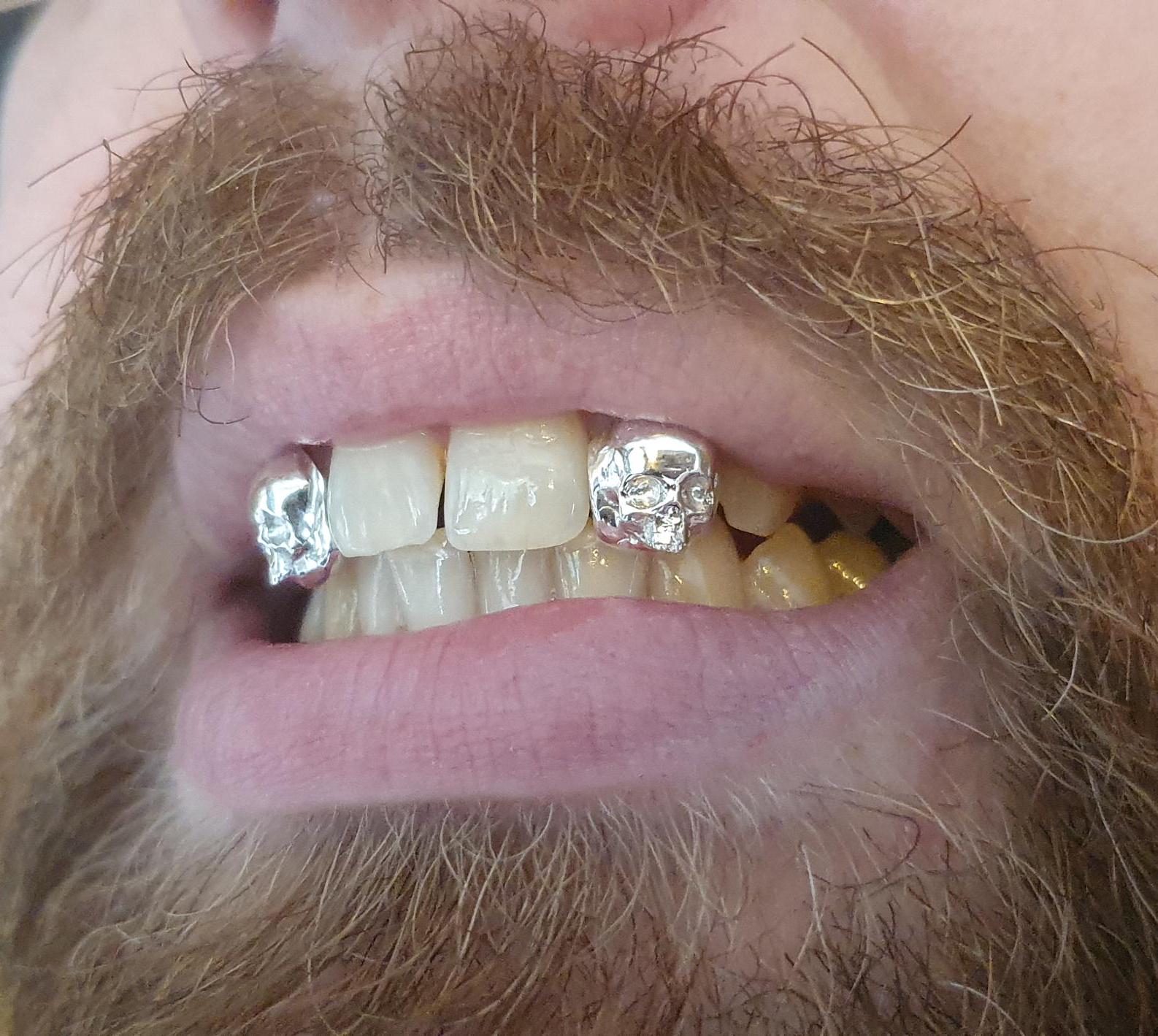 SKULL Custom Grillz Dental Caps Worldwide Delivery - Etsy