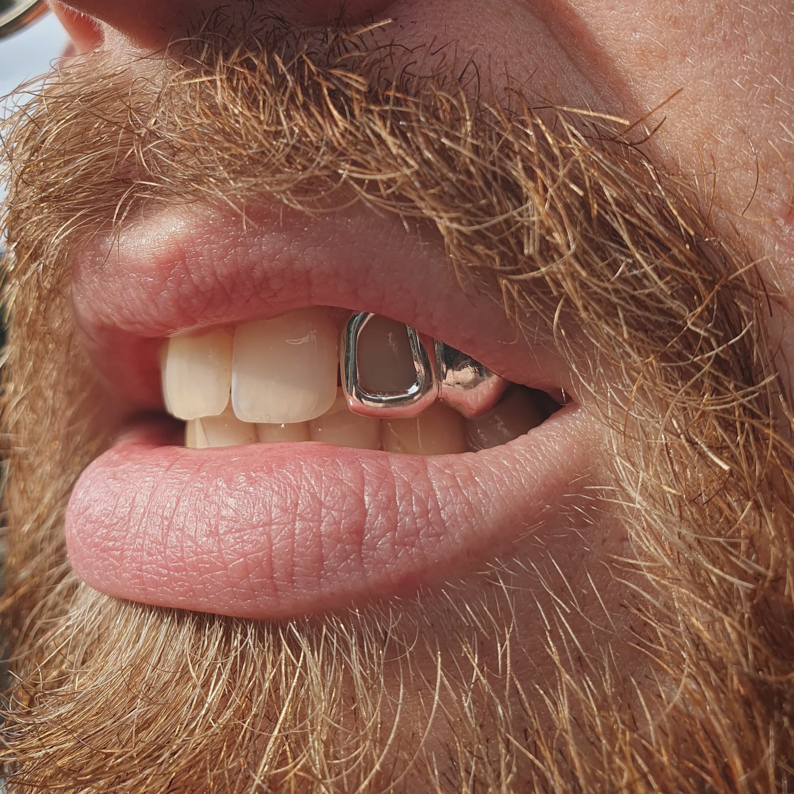 WINDOW Custom Grillz Dental Caps Worldwide Delivery - Etsy