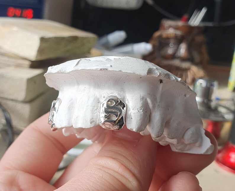 LETTER GRILLZ Custom Grillz Dental Caps Worldwide Delivery - Etsy