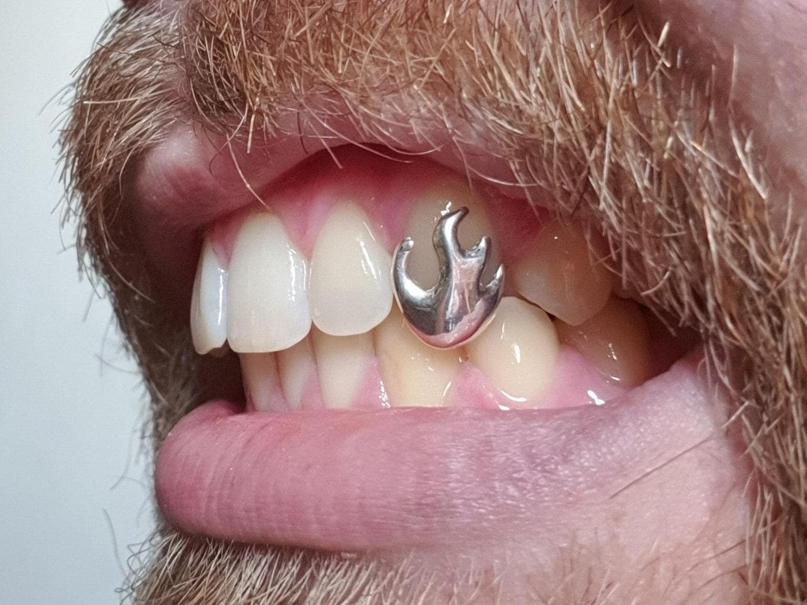 FLAME Custom Grillz Dental Caps Worldwide Delivery - Etsy