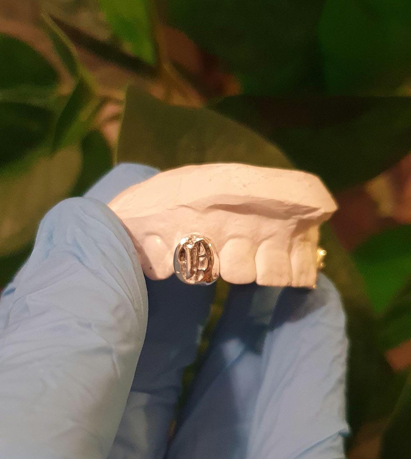 LETTER GRILLZ Custom Grillz Dental Caps Worldwide Delivery - Etsy