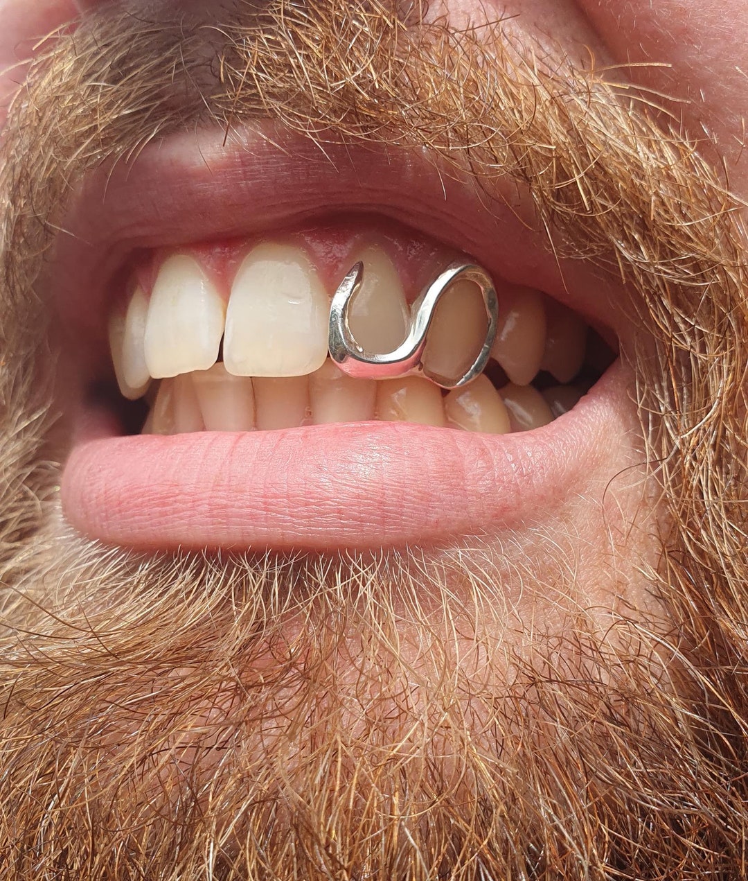 WAVE Custom Grillz Dental Caps Worldwide Delivery - Etsy