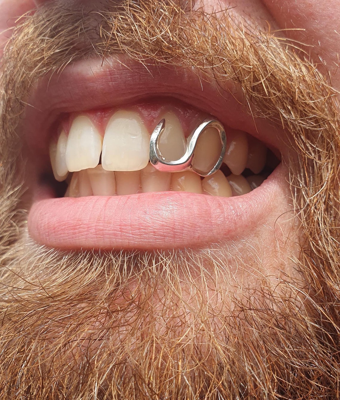 WAVE Custom Grillz Dental Caps Worldwide Delivery - Etsy