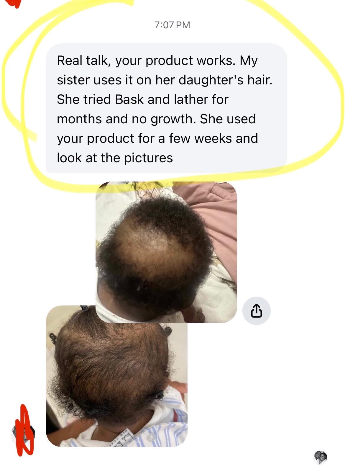 Real Results: Batana, Rosemary, Coconut, Tea Tree, Castor Oil- Fast ...