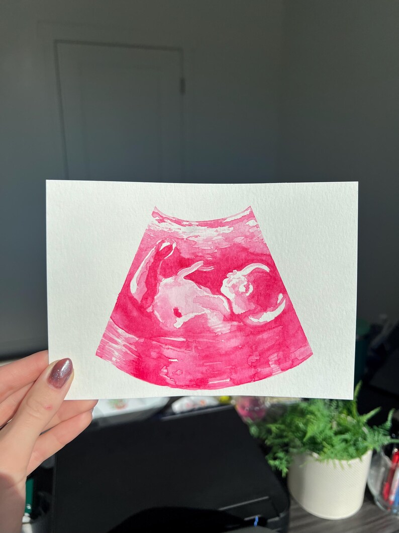 Cute Watercolor Ultrasound | Pink, Blue, Black | 5x7 | Handpainted - Etsy
