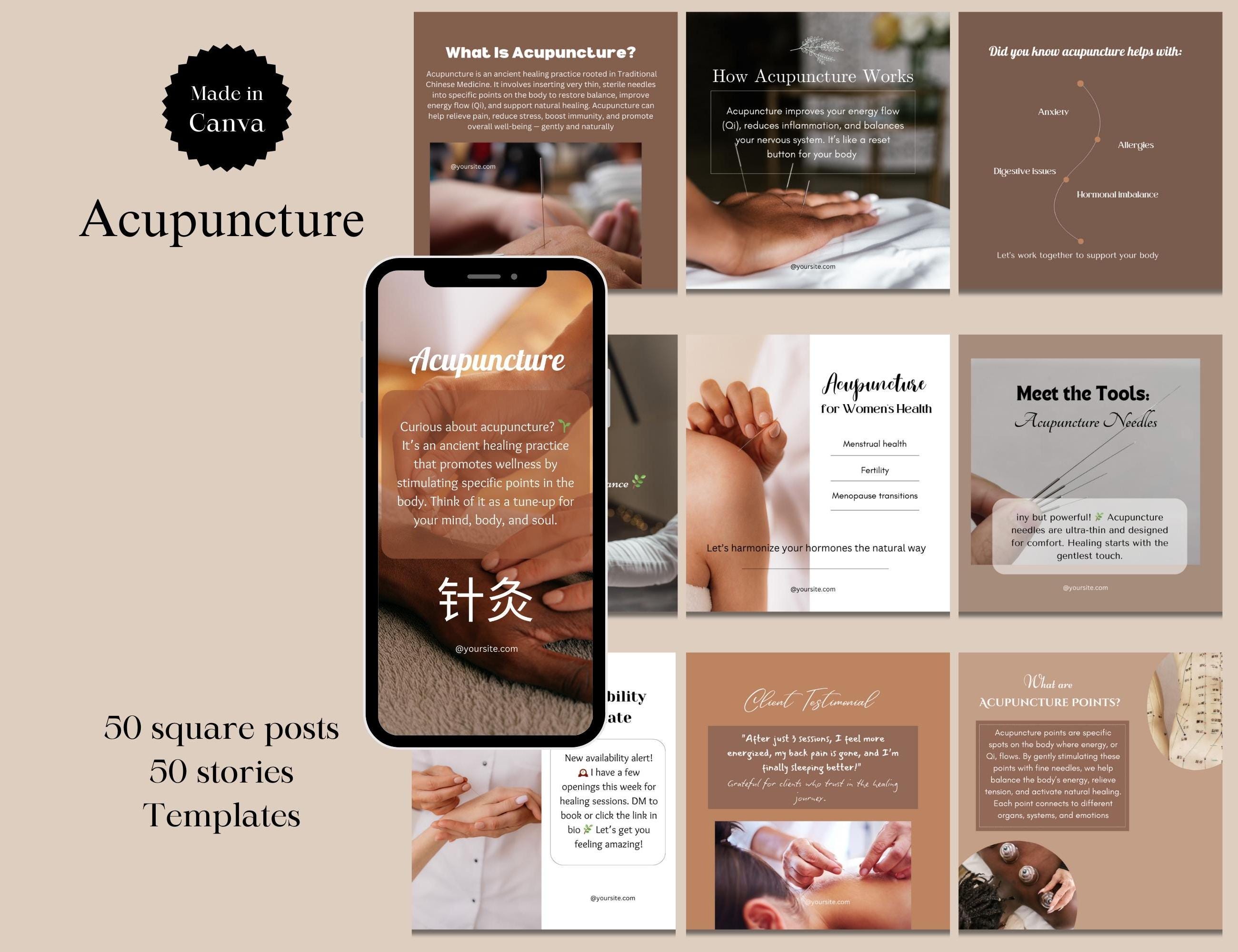Acupuncture Instagram Templates | TCM Social Media Canva Bundle ...