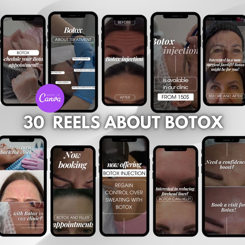 30 Botox Instagram Video Reels | Skincare Video | Botox Canva Template ...