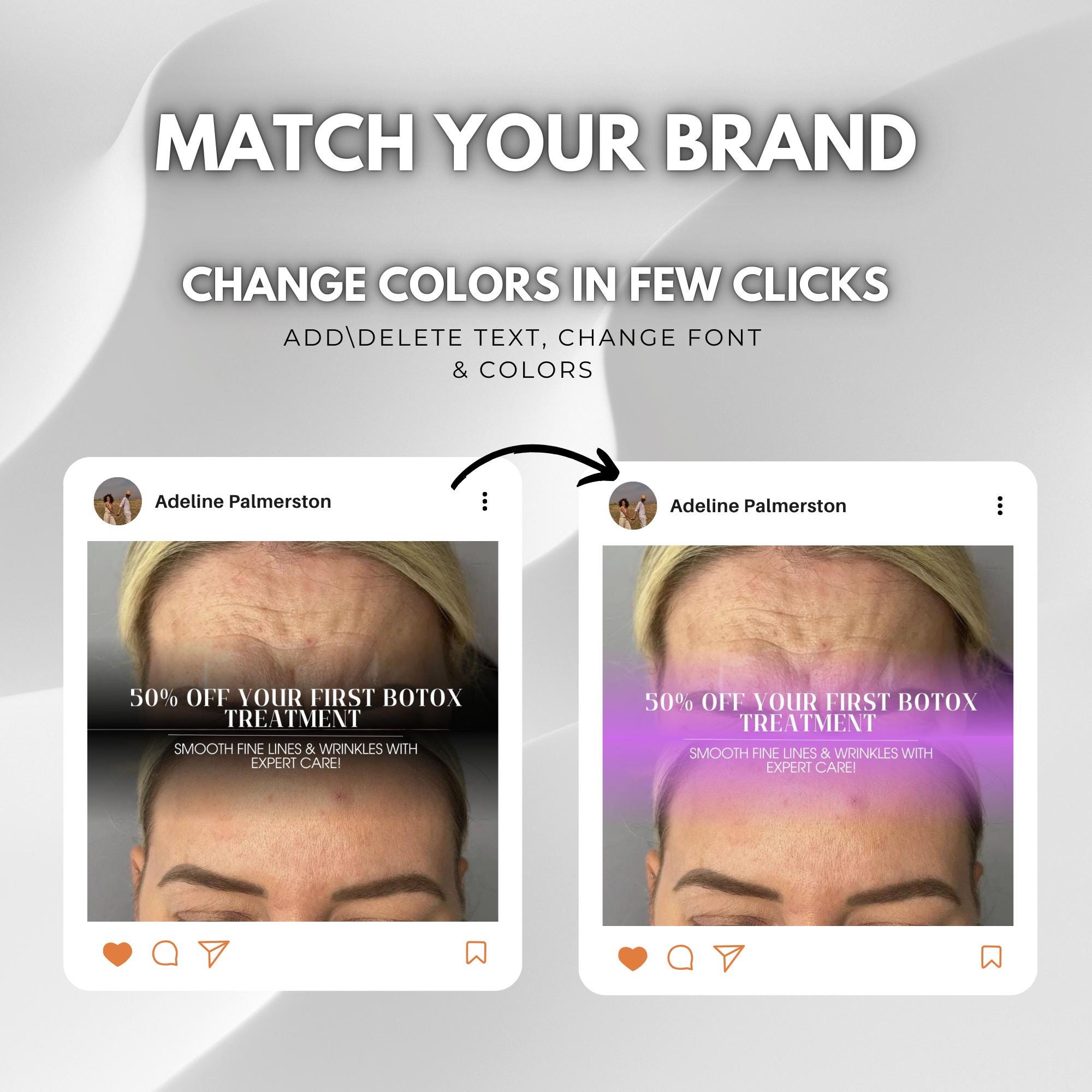 30 Botox Instagram Posts | Botox Before and After | Skincare | Botox ...