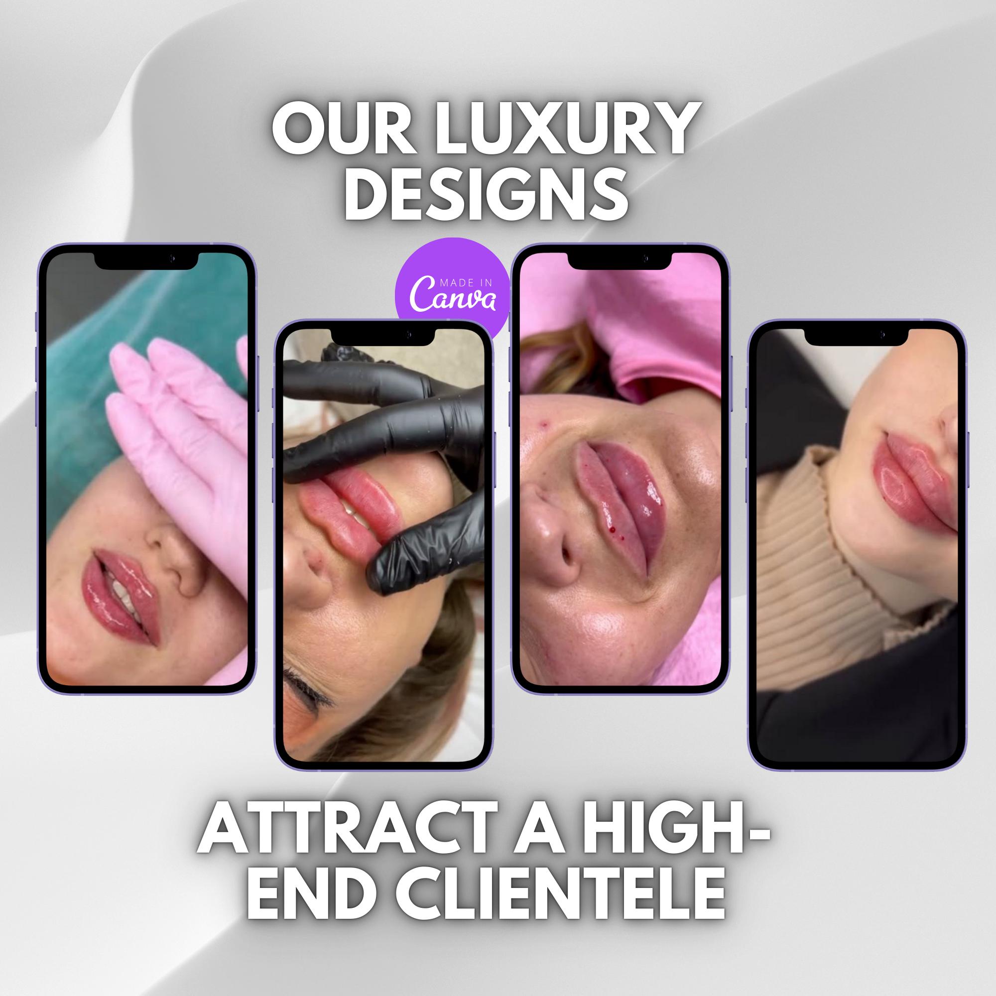 60 Lip Filler Reels Instagram, Lip Injection Reels Canva Template ...