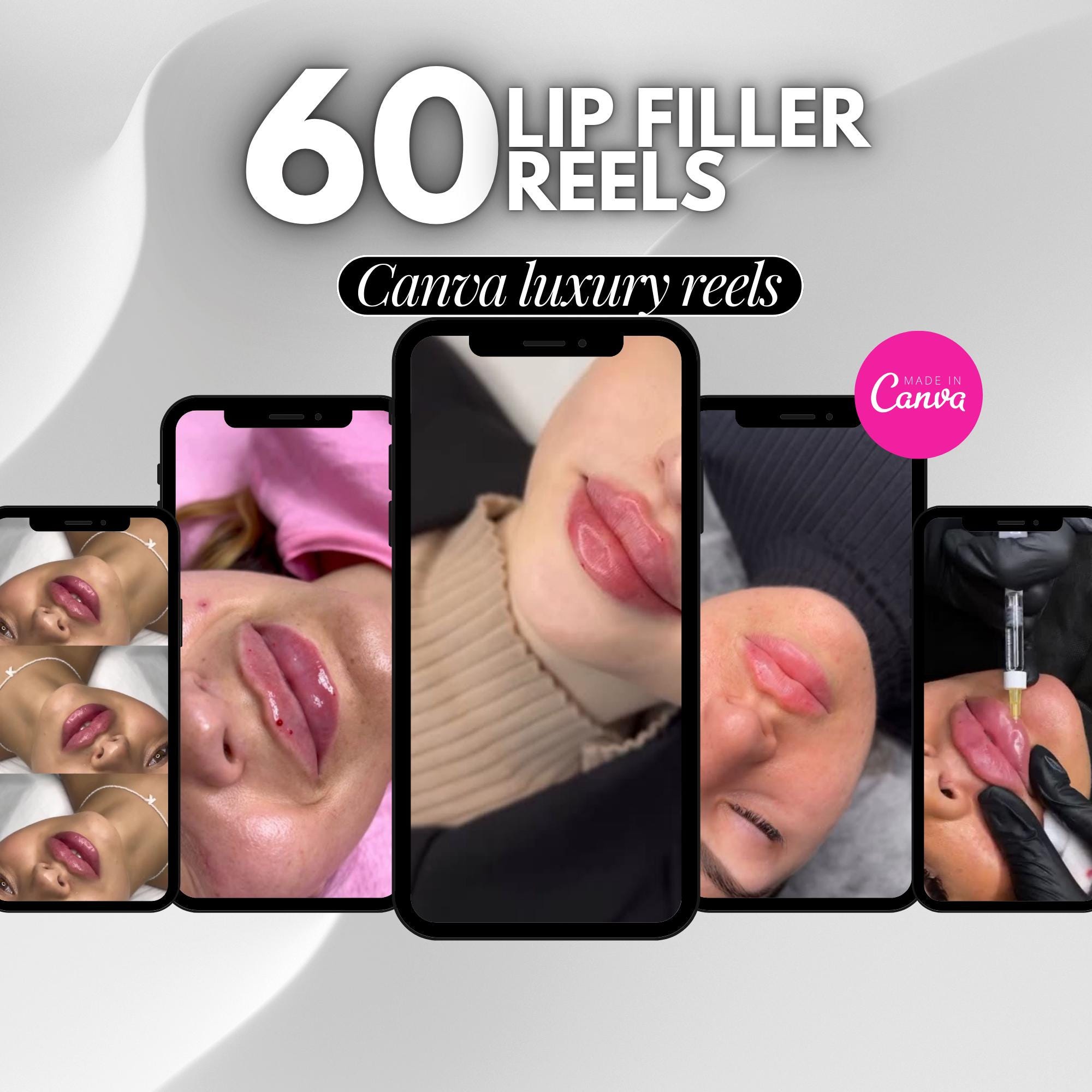 60 Lip Filler Reels Instagram, Lip Injection Reels Canva Template ...