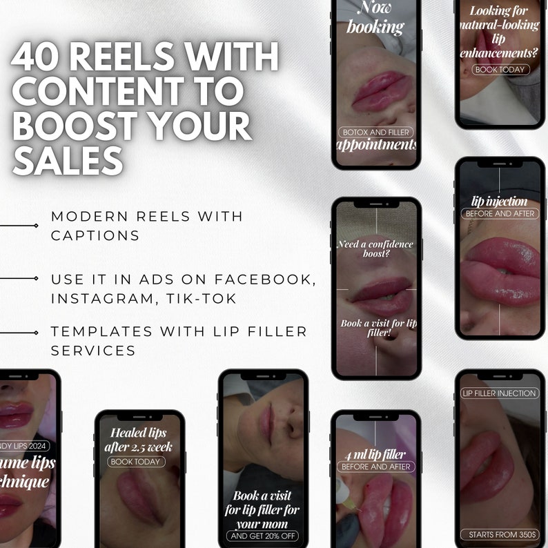 40 Lip Filler Video Instagram Reels, Lip Injection Reels Canva Template ...