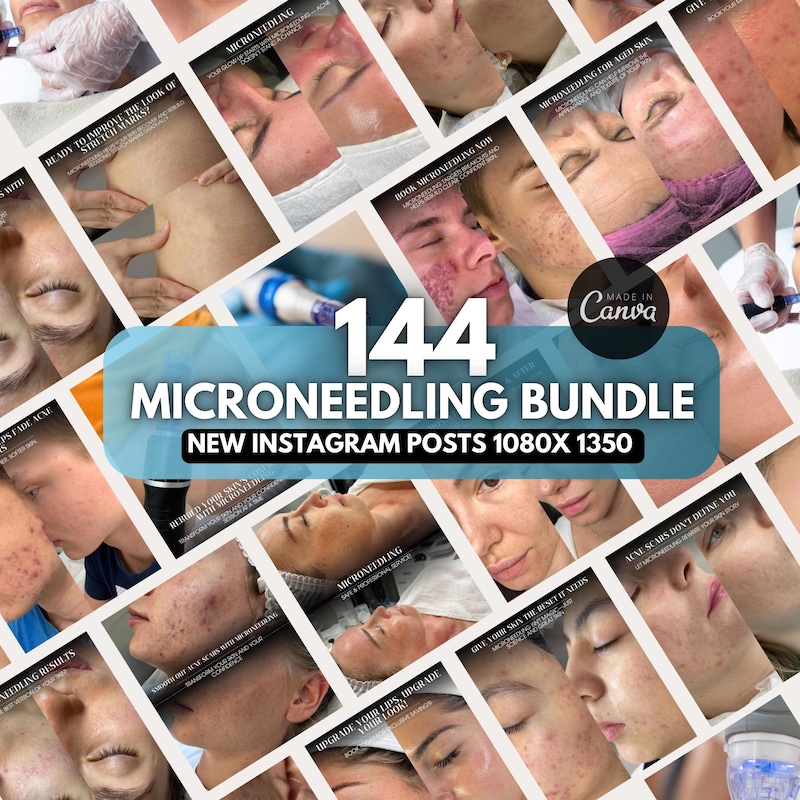 Lips and Microneedling - Etsy