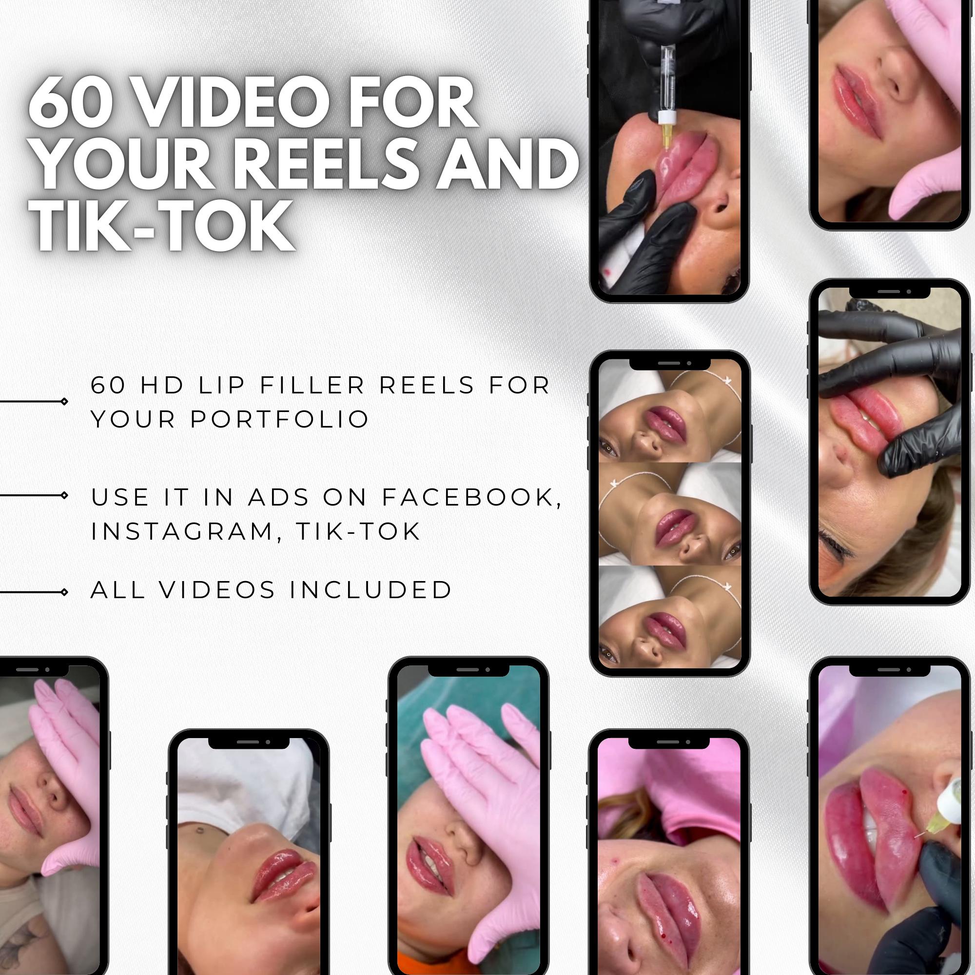 60 Lip Filler Reels Instagram, Lip Injection Reels Canva Template ...