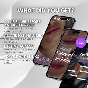 40 Lip Filler Video Instagram Reels, Lip Injection Reels Canva Template ...