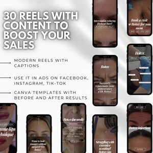 30 Botox Instagram Video Reels | Skincare Video | Botox Canva Template ...