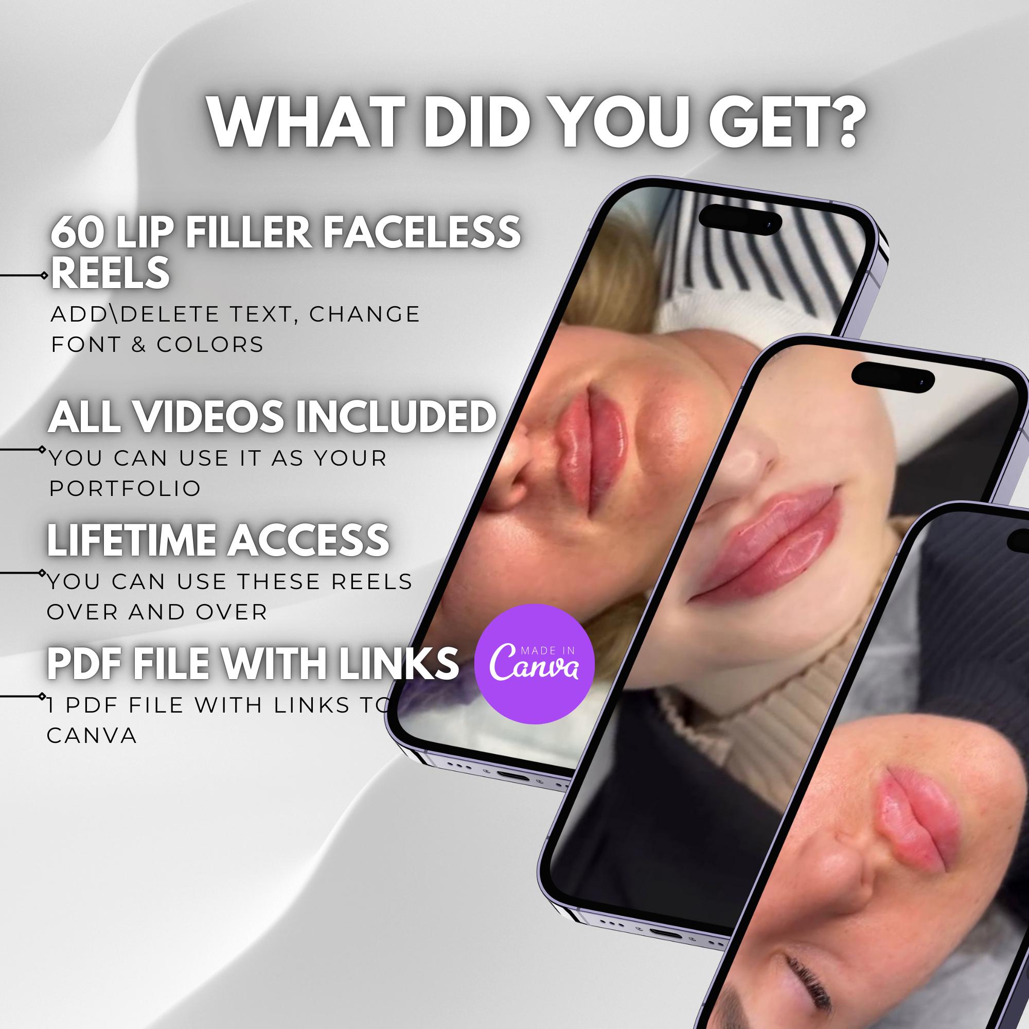 60 Lip Filler Reels Instagram, Lip Injection Reels Canva Template ...