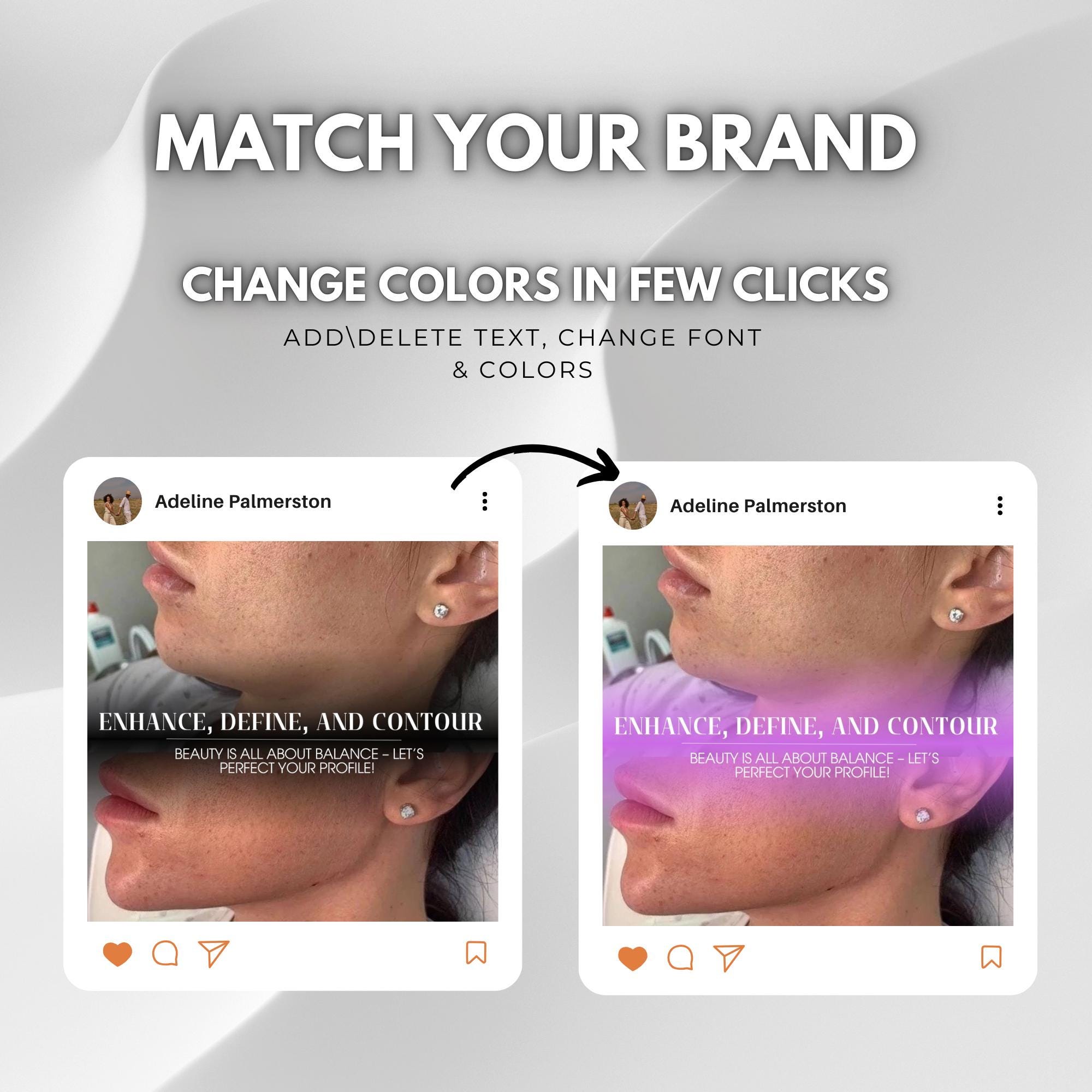60 Dermal Filler Instagram Posts | Face Filler Injection Before and ...