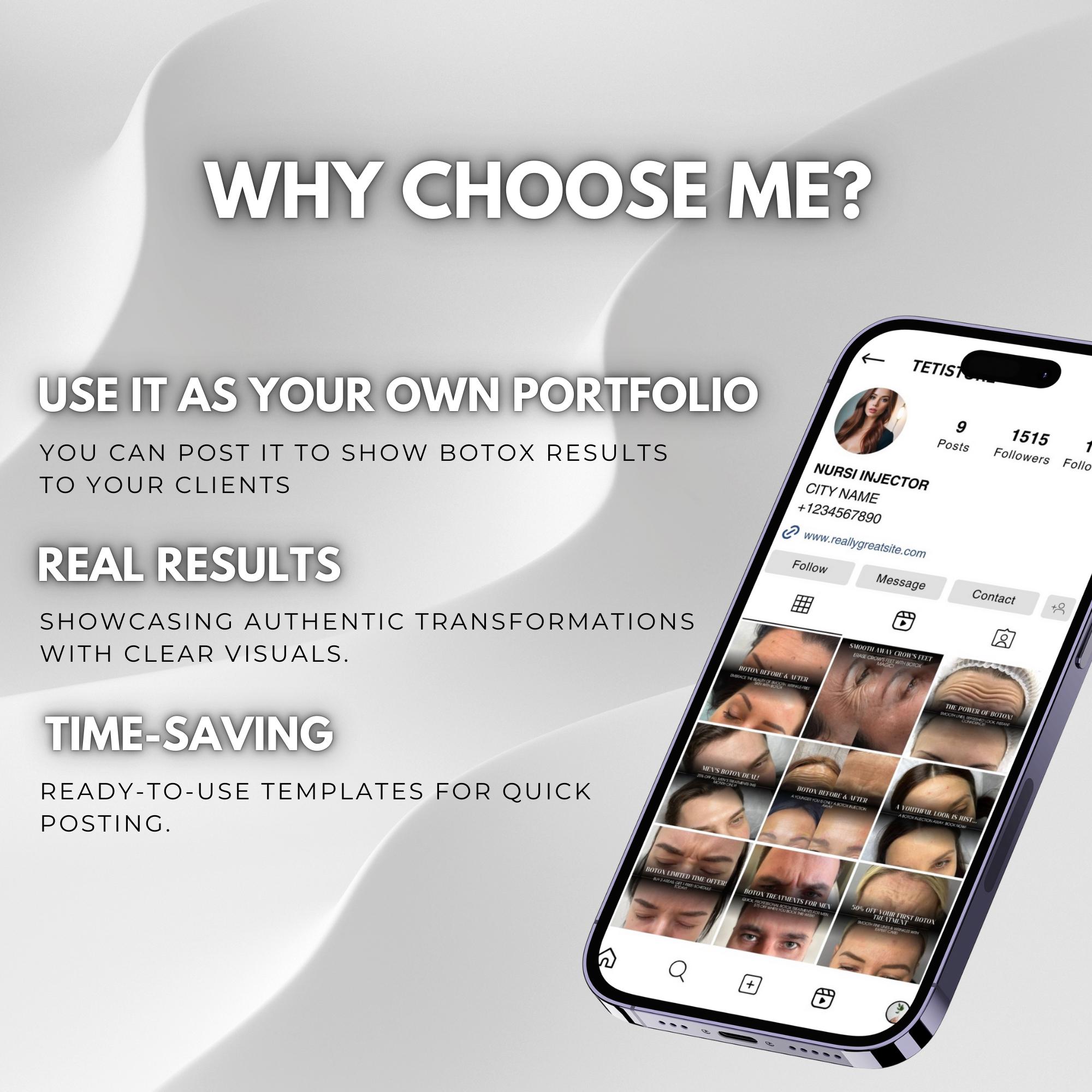 30 Botox Instagram Posts | Botox Before and After | Skincare | Botox ...