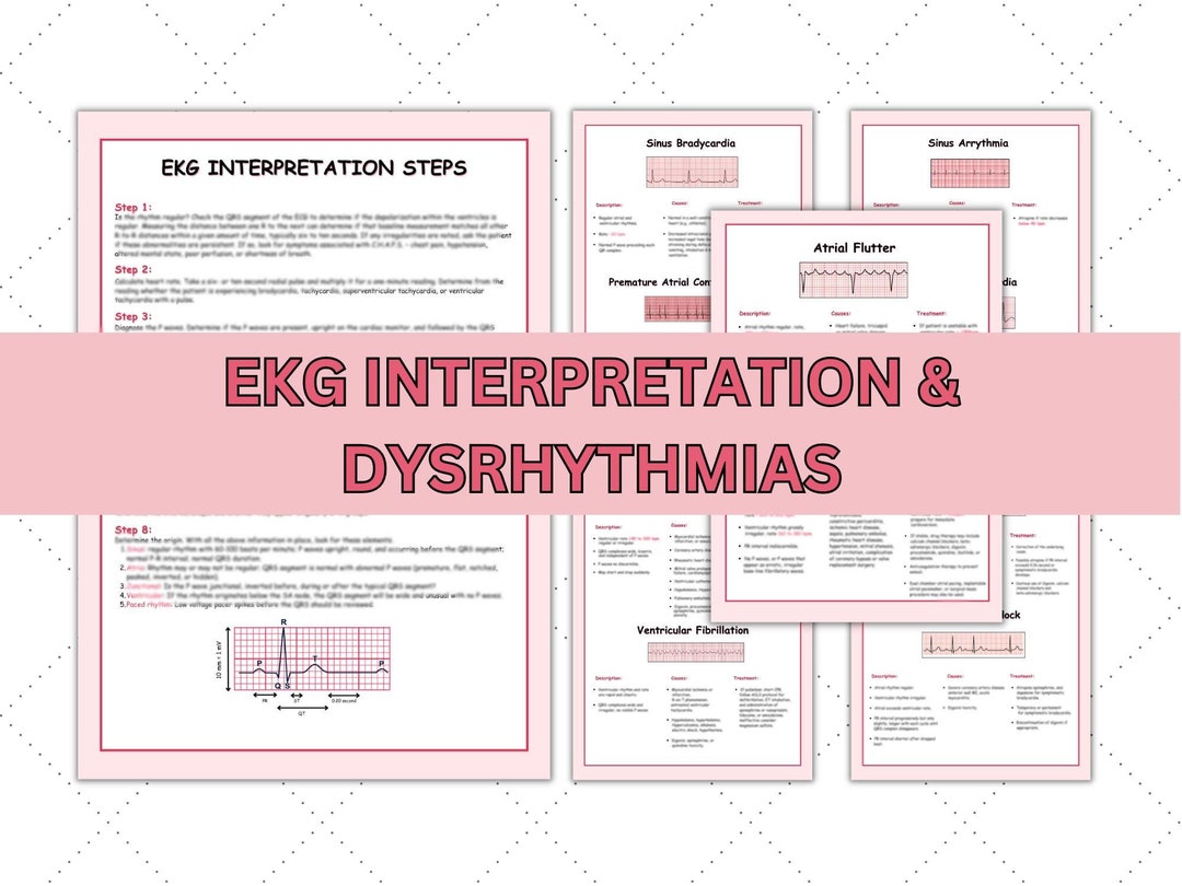 EKG Interpretation Study Guide, EKG Arrhythmias Cheat Sheet, Nursing ...