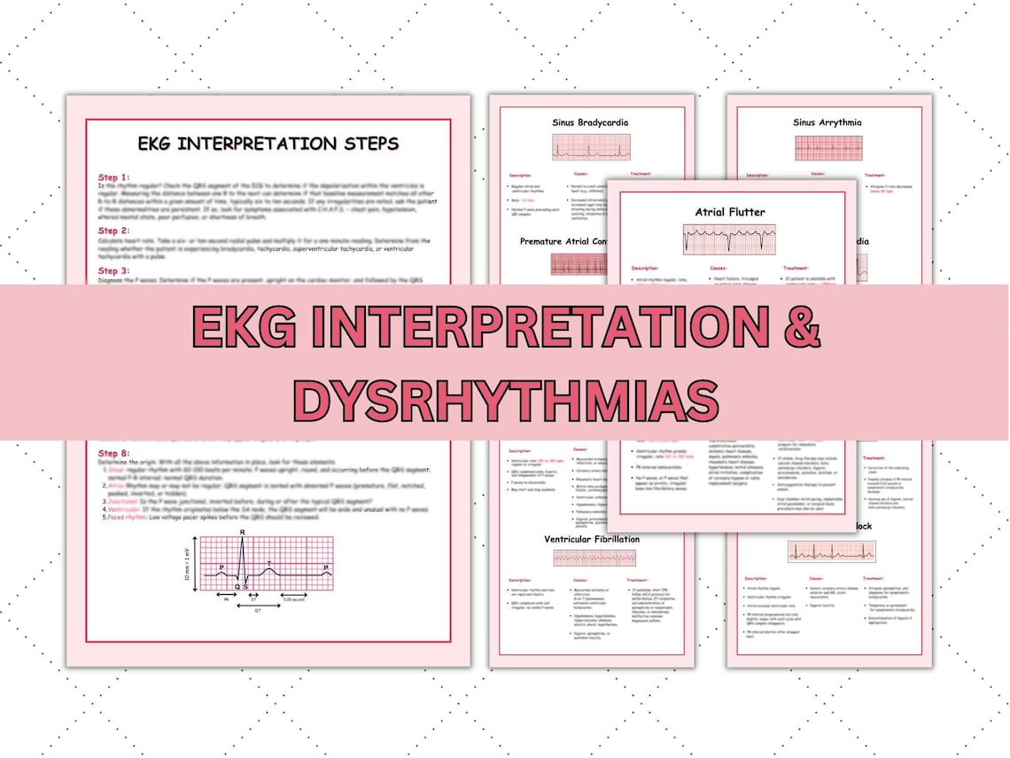 EKG Interpretation Study Guide, EKG Arrhythmias Cheat Sheet, Nursing ...