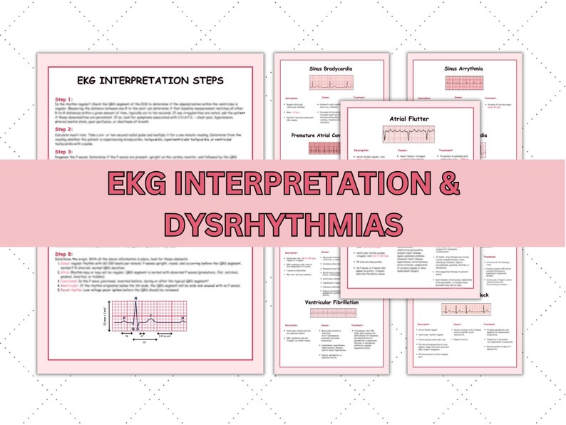 EKG Interpretation Study Guide, EKG Arrhythmias Cheat Sheet, Nursing ...
