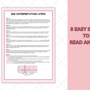 EKG Interpretation Study Guide, EKG Arrhythmias Cheat Sheet, Nursing ...