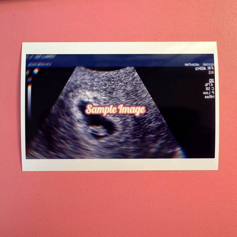 Personalized 4x6 Print Ultrasound Art, Nursery Wall Decor, Ultrasound ...