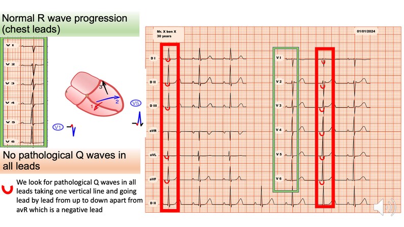 ECG Interpretation - USMLE STEP 1 - Etsy