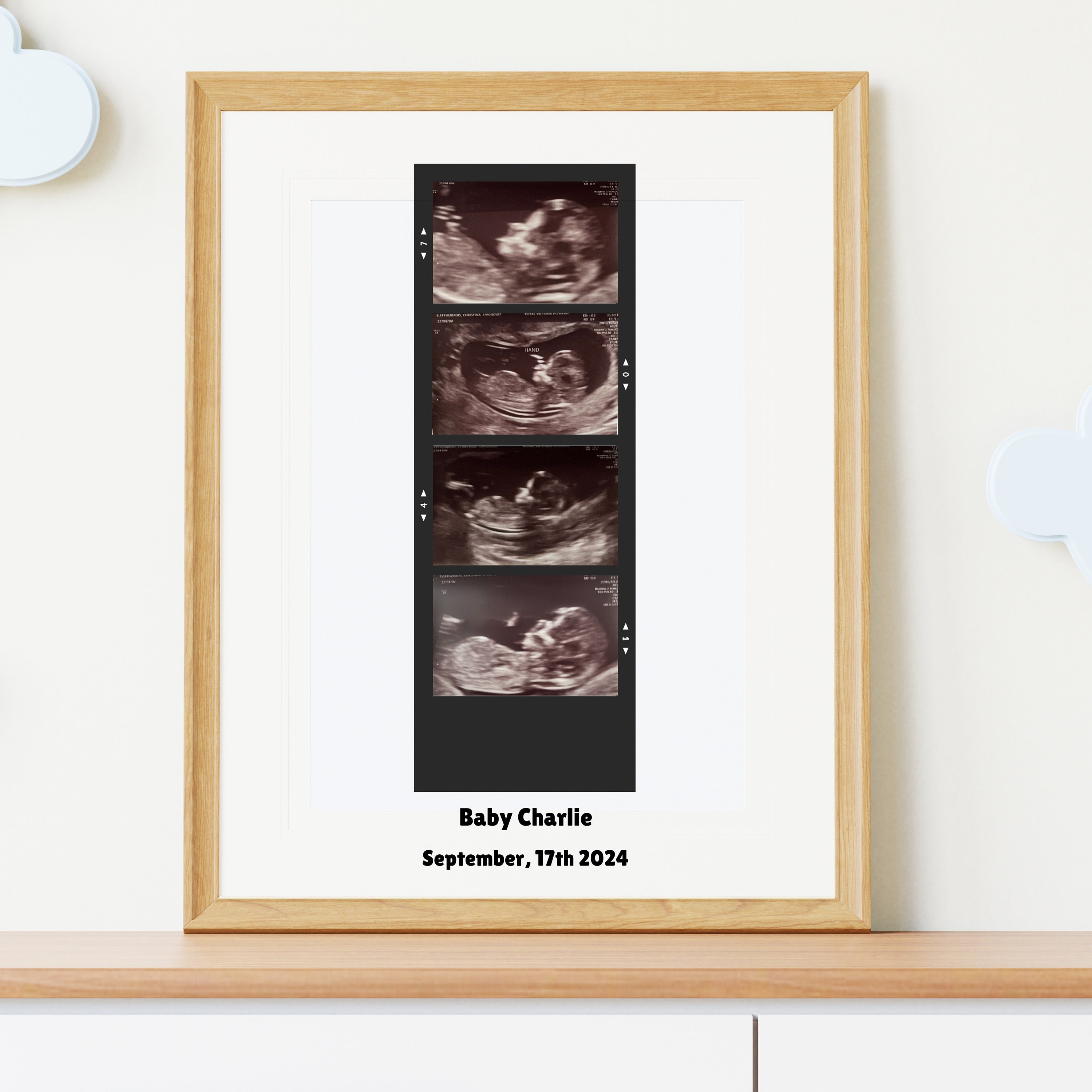 Digital Custom Baby Ultrasound Baby Scan Keepsake Nursery Wall Art ...