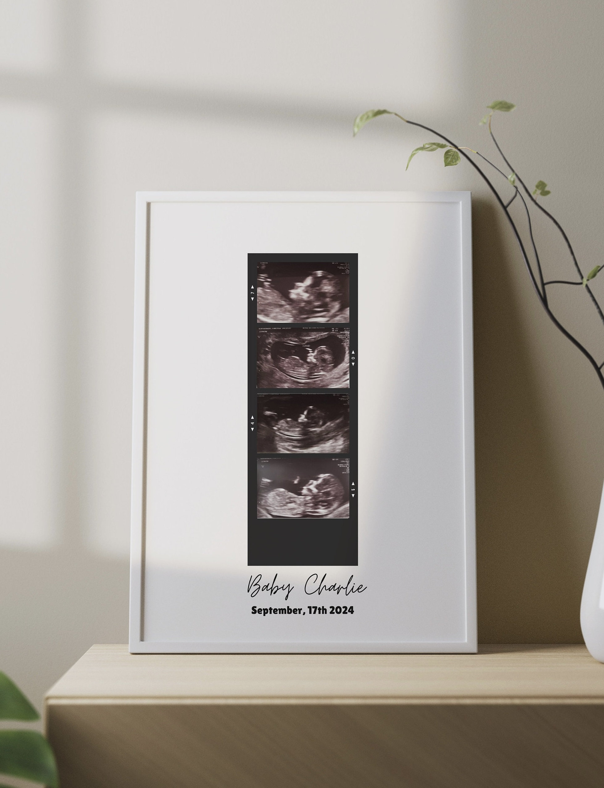 Digital Custom Baby Ultrasound Baby Scan Keepsake Nursery Wall Art ...