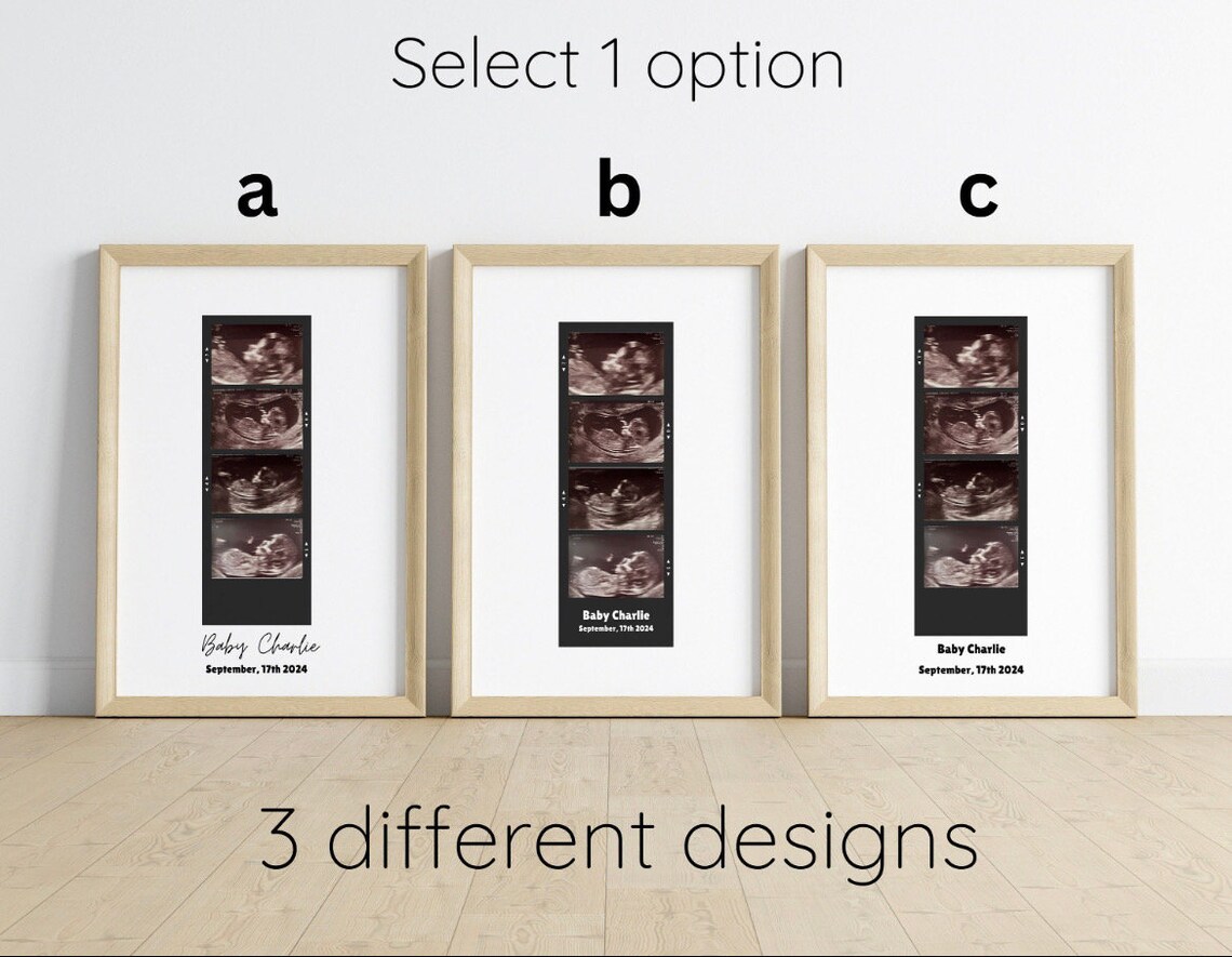 Digital Custom Baby Ultrasound Baby Scan Keepsake Nursery Wall Art ...