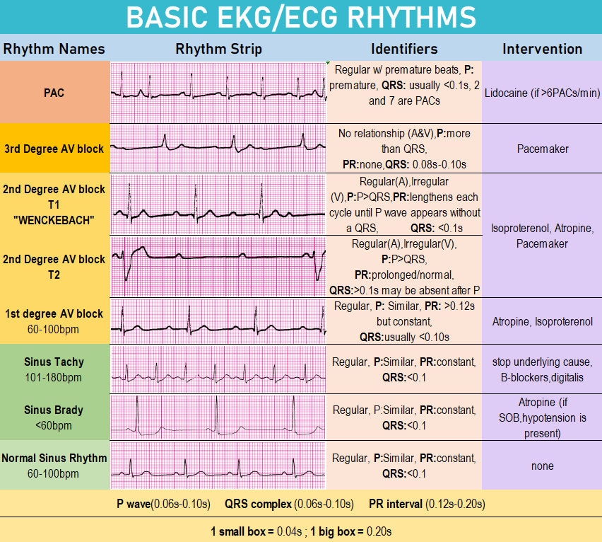 ECG Rhythms and Intervention - Etsy