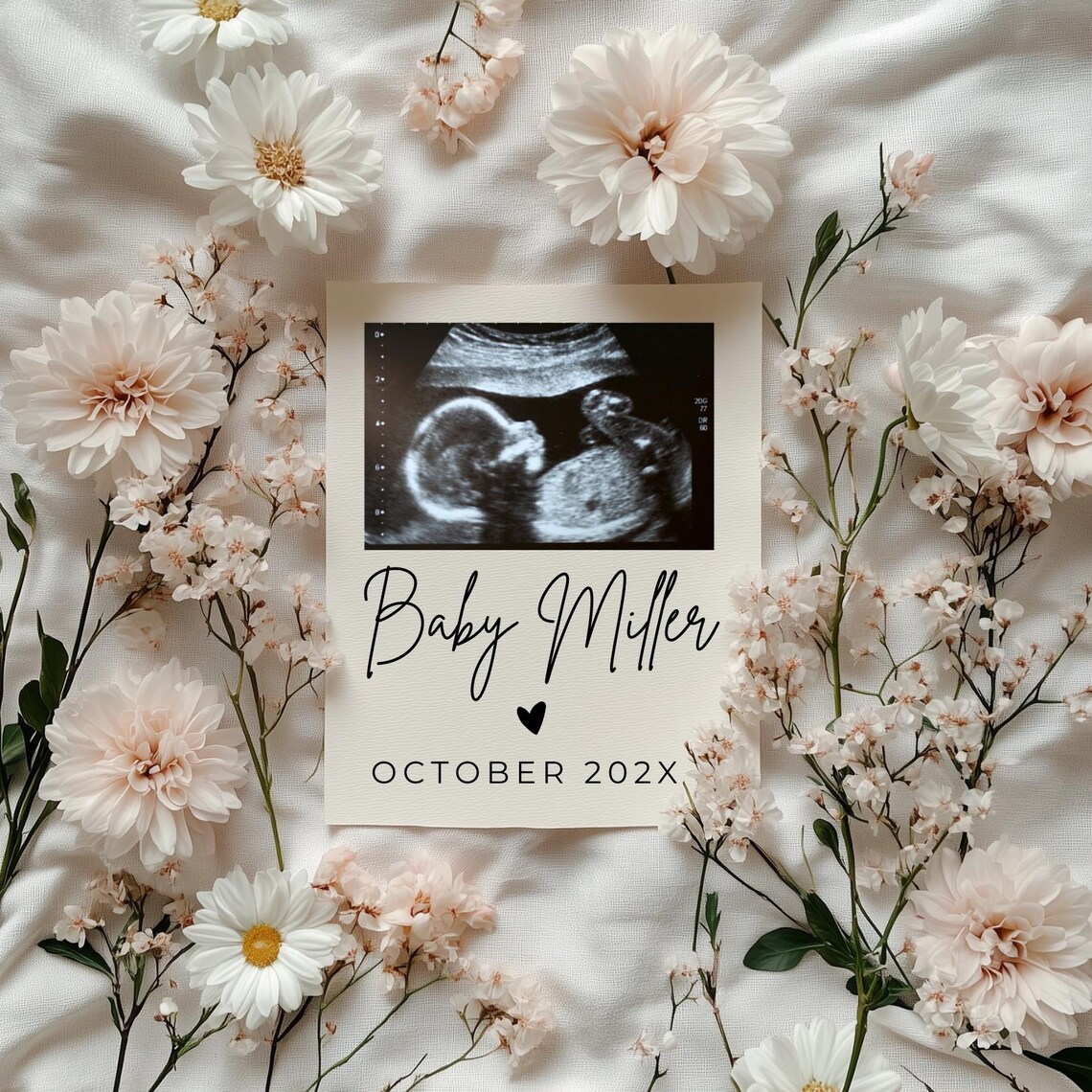 Floral Spring Pregnancy Announcement Digital Cherry Blossom Sakura Baby ...