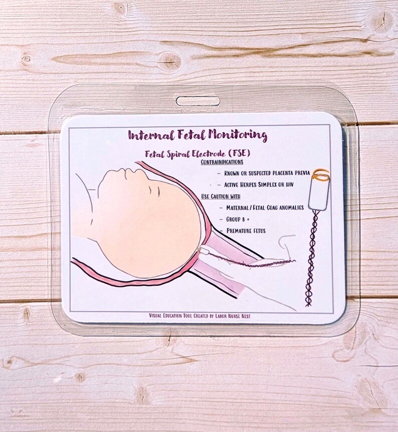 Labor Nurse Fetal Monitoring Badge Buddy | IUPC & FSE Visual Aid - Etsy