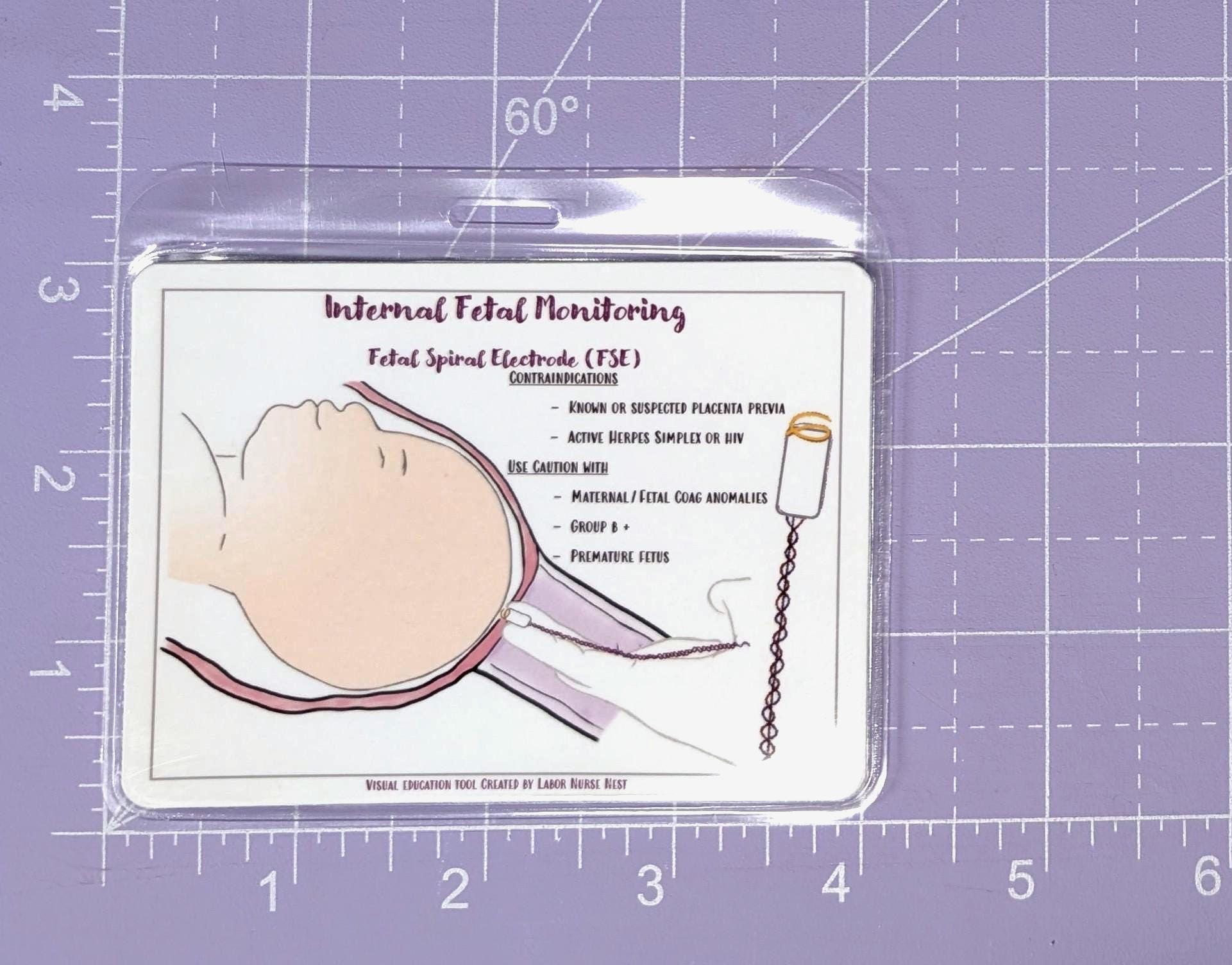 Labor Nurse Fetal Monitoring Badge Buddy | IUPC & FSE Visual Aid - Etsy