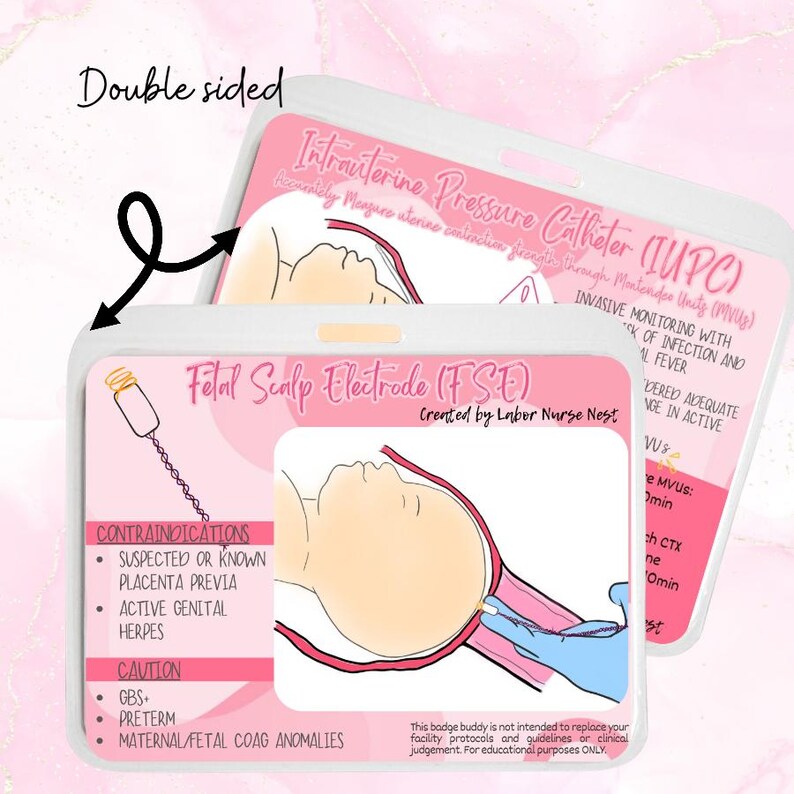 Internal Fetal Monitoring Badge Buddy | Labor and Delivery Nurse IUPC ...