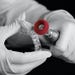 Custom Orthodontic Replacement Retainer With Free Case and Impression ...