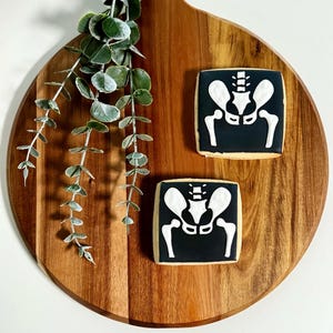 Xray Radiology Technician Appreciation Custom Sugar Cookies - Etsy