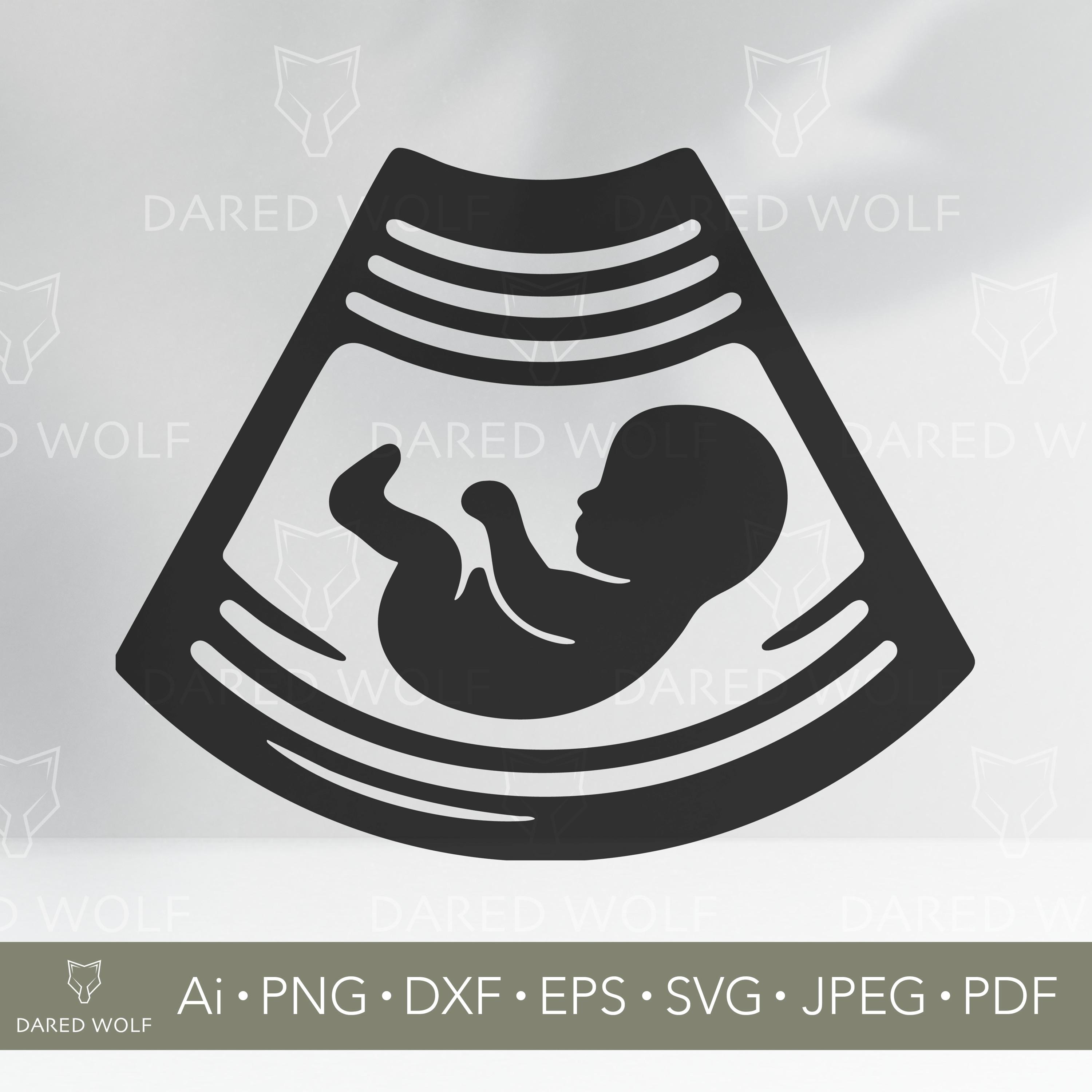 Baby Sonogram SVG: Ultrasound Clipart for Pregnancy Reveal (digital ...
