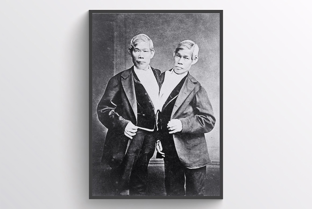 Victorian Era Conjoined Twins Black & White Digital Download - 17 Sizes ...