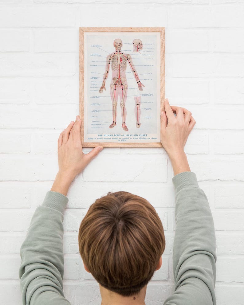 Medical Illustration Rolled Posters - Pressure Points Body Bleeding ...