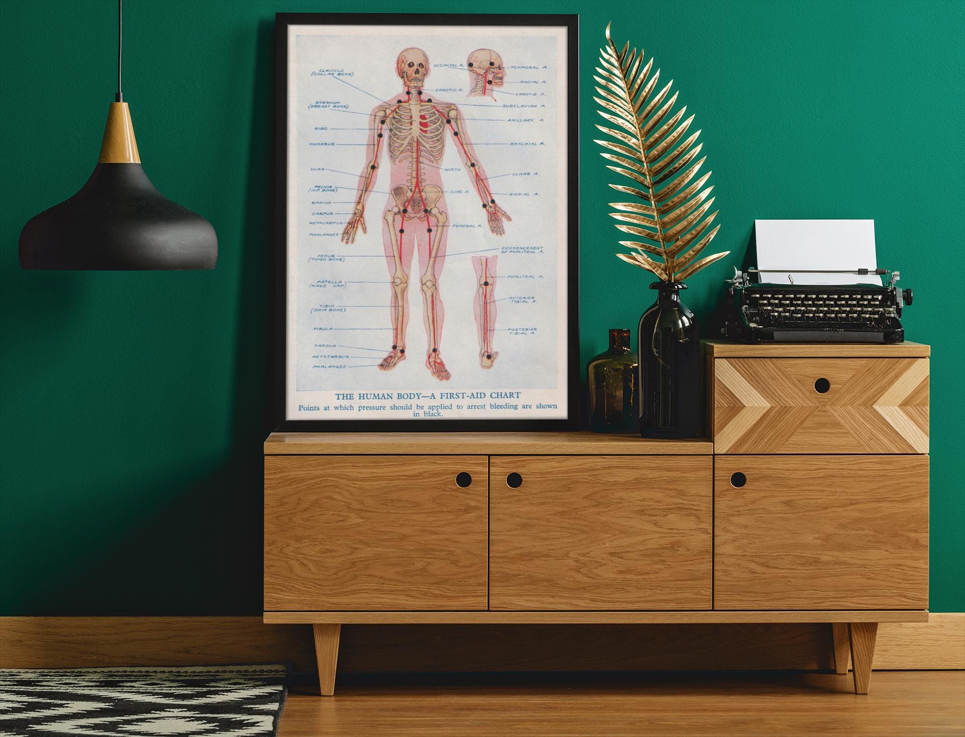 Medical Illustration Rolled Posters - Pressure Points Body Bleeding ...