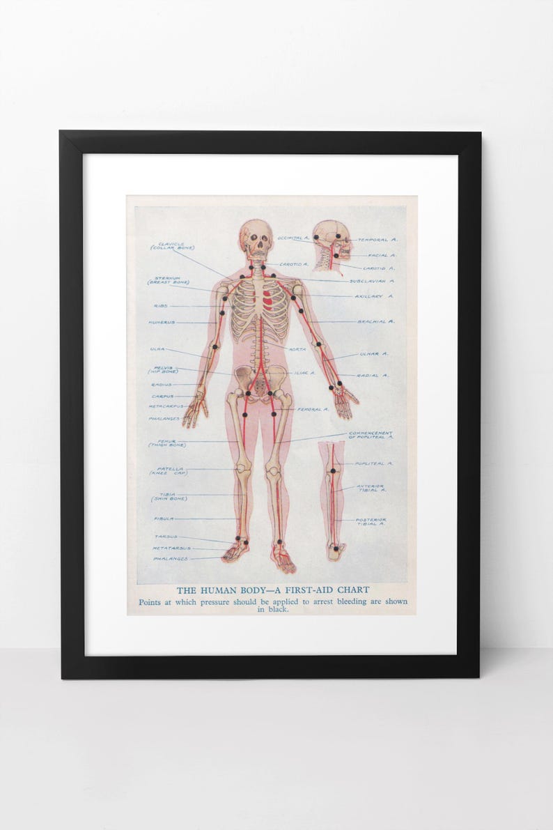 Medical Illustration Rolled Posters - Pressure Points Body Bleeding ...