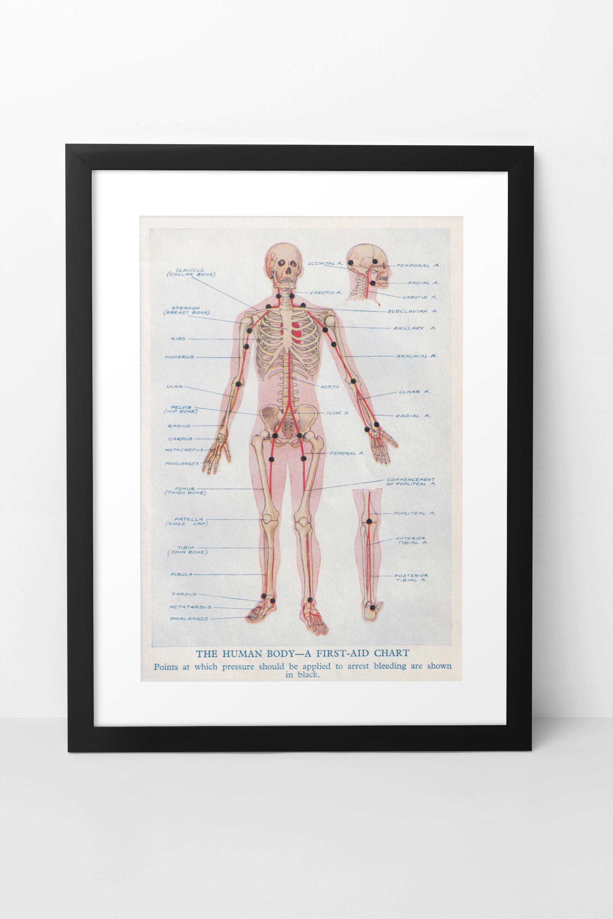 Medical Illustration Rolled Posters - Pressure Points Body Bleeding ...