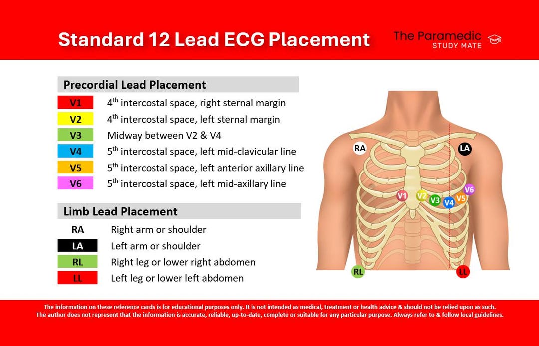 Paramedic Standard 12 Lead ECG Placement Plastic PVC Reference Card - Etsy