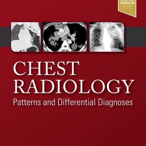 Chest Radiology: Patterns and Differential Diagnoses, 7e - Etsy